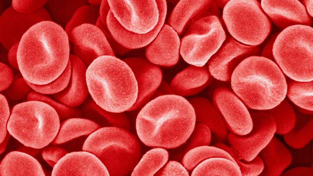 ‘In the Blood’ traces how a lifesaving product almost didn’t make it ...